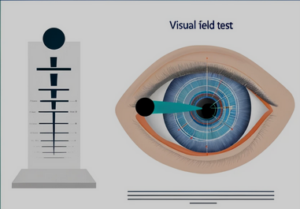 Comprendre L'examen du Champ Visuel en 4 étapes
